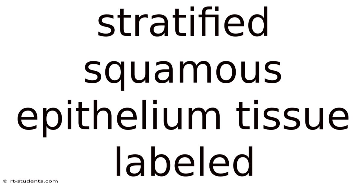 Stratified Squamous Epithelium Tissue Labeled